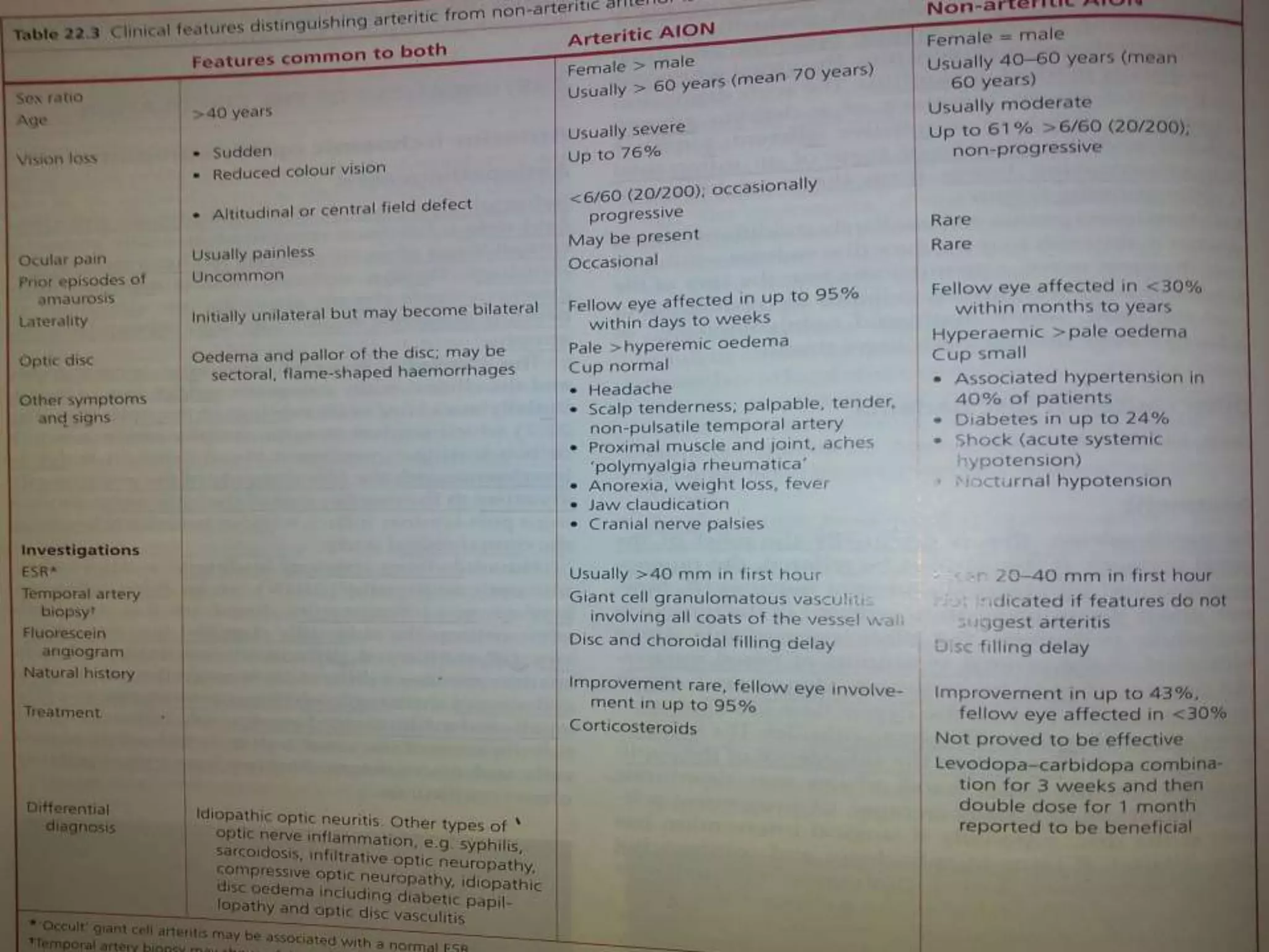 Anterior ischemic optic neuropathy (AION).pptx