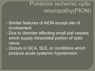 Anterior ischemic optic neuropathy (AION).pptx