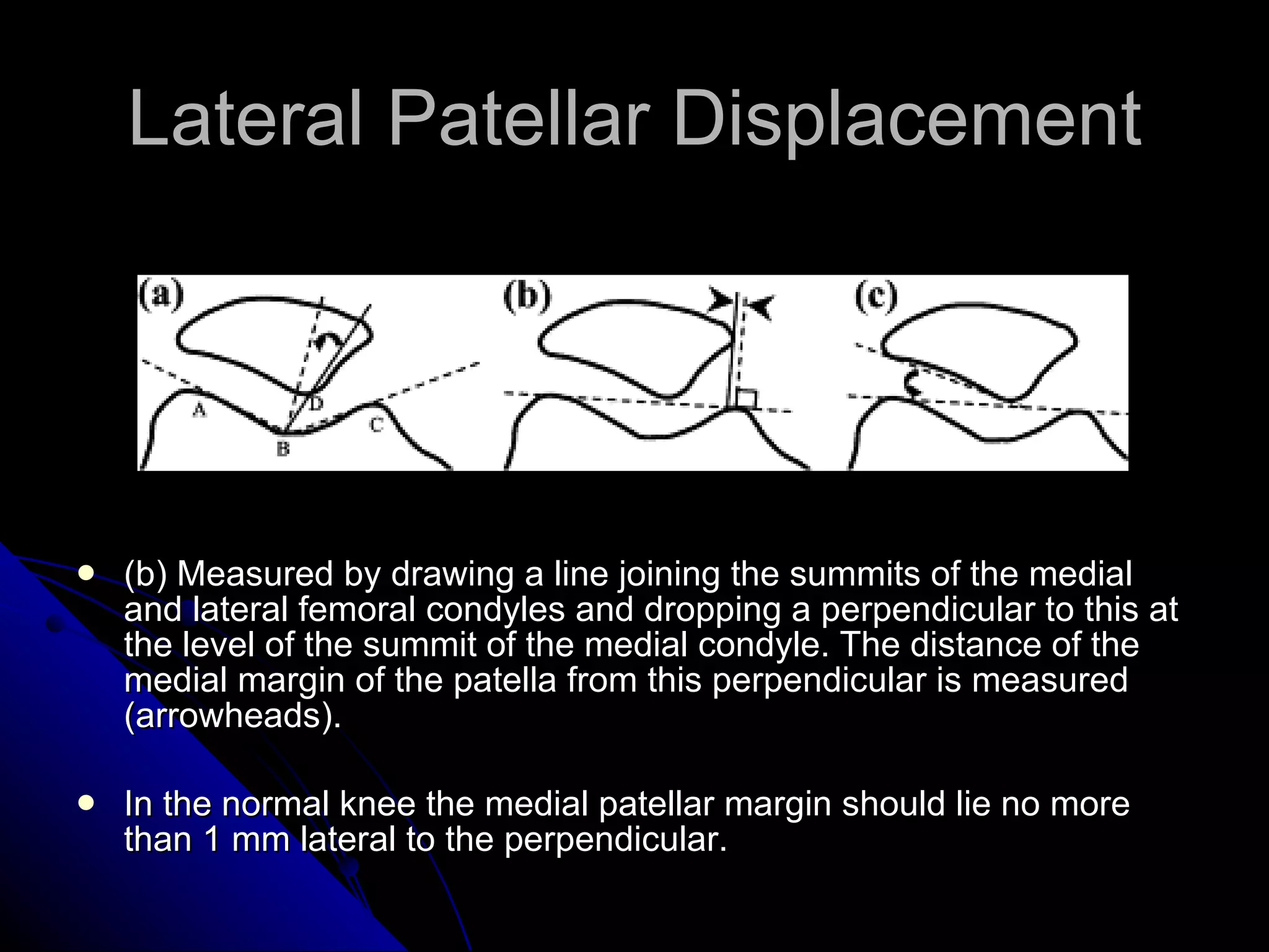 Anterior knee pain | PPT