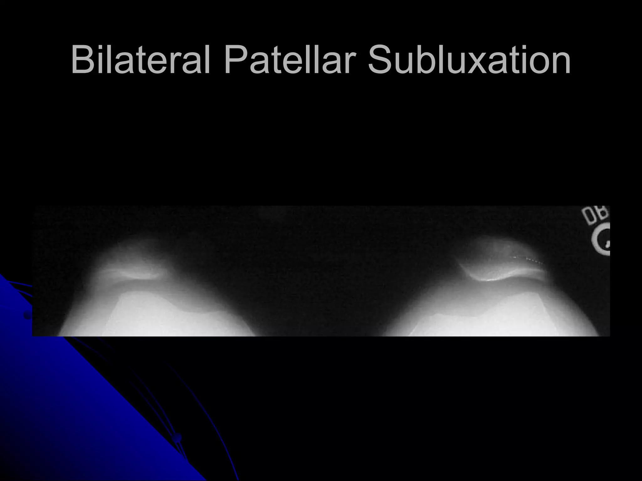 Anterior knee pain | PPT