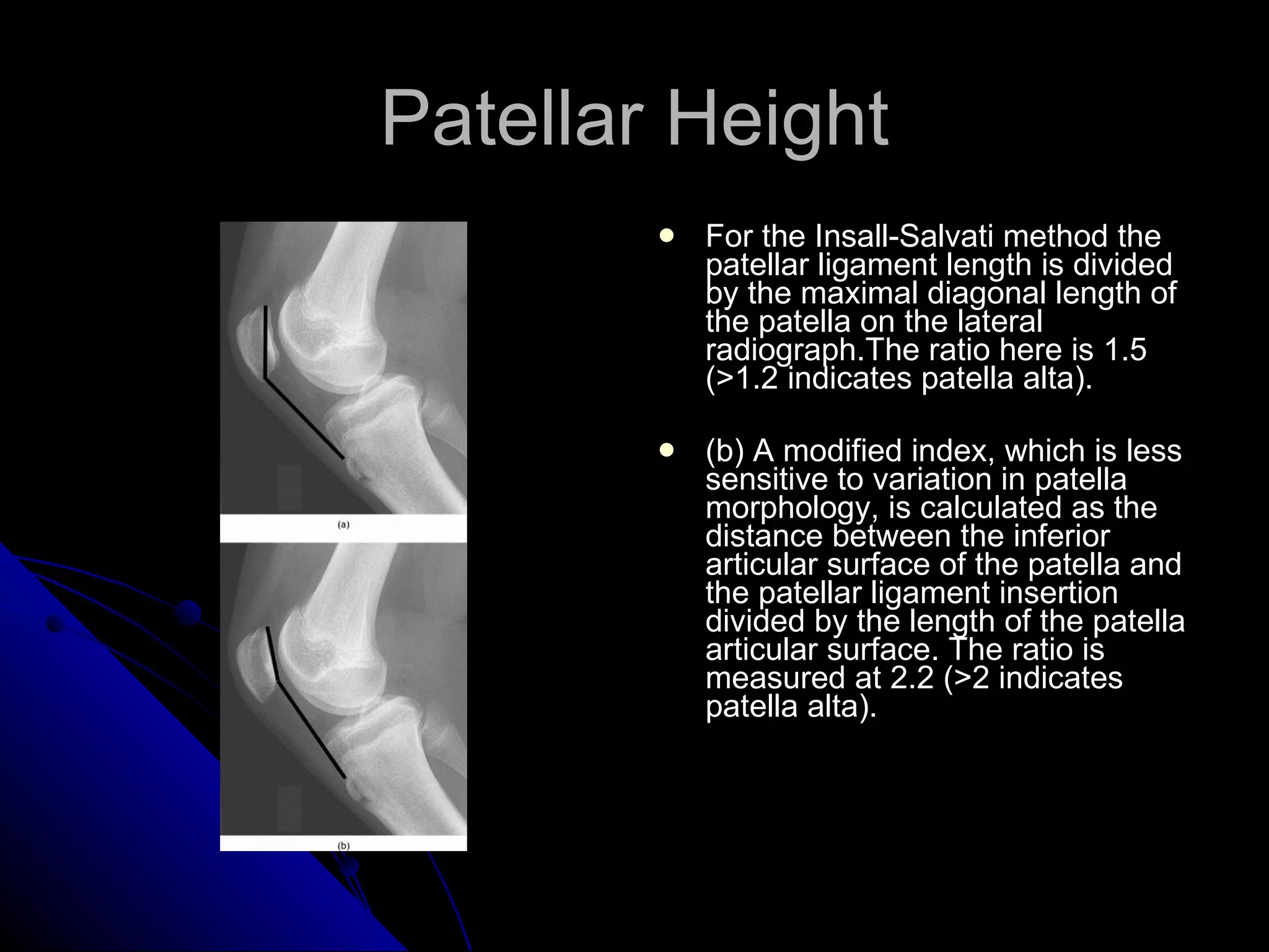 Anterior knee pain | PPT