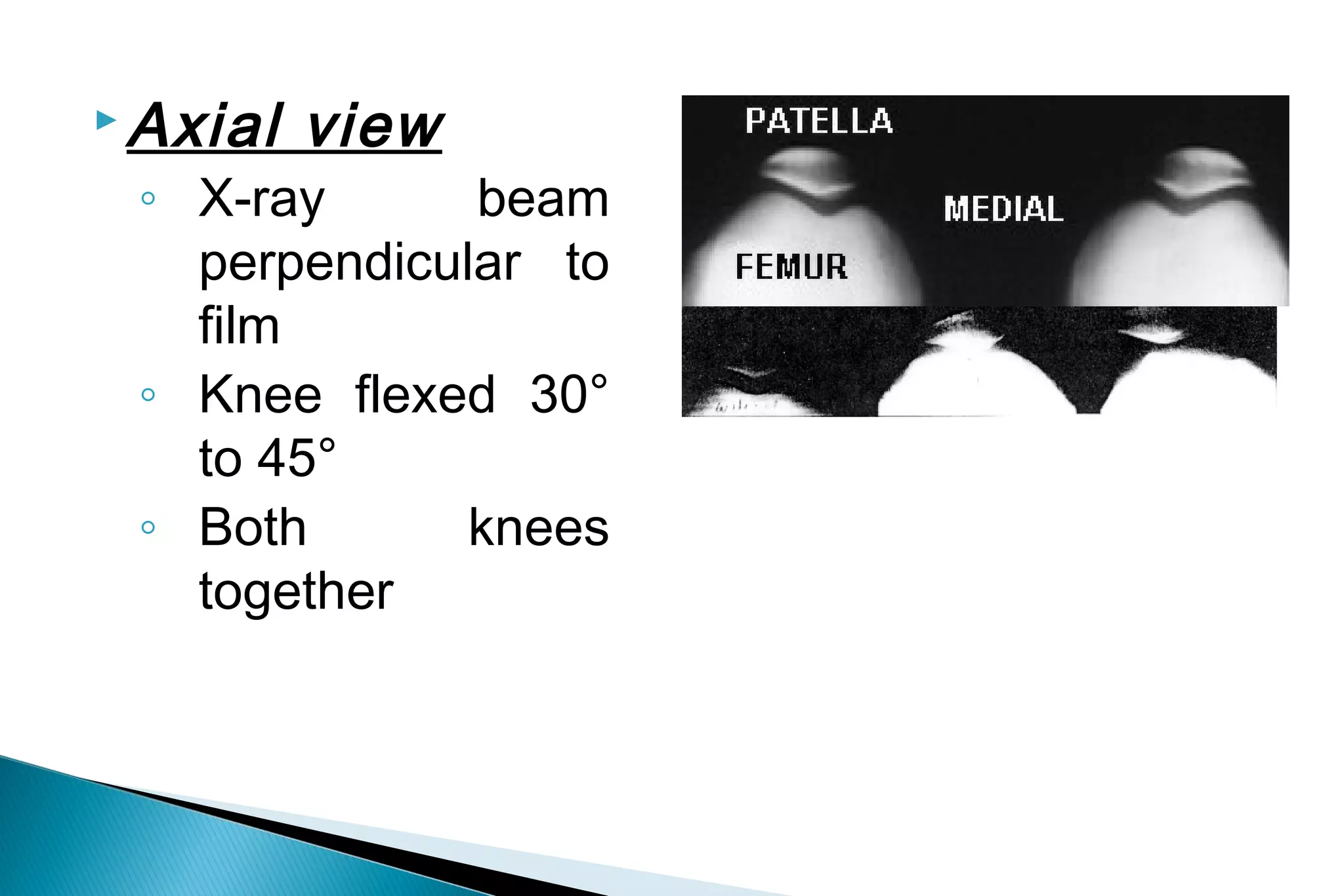 Anterior knee pain | PPT