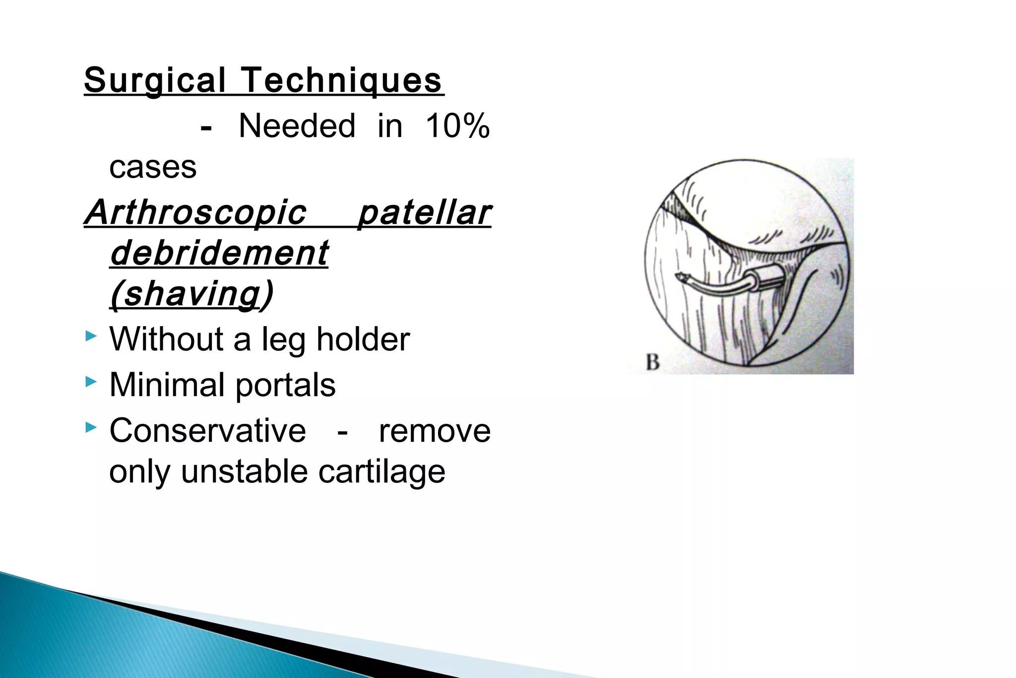 Anterior knee pain | PPT