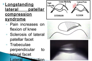 Anterior knee pain | PPT