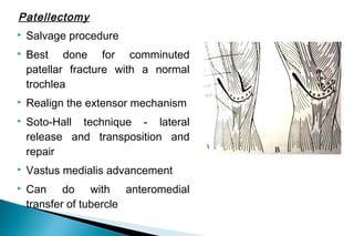 Anterior knee pain | PPT