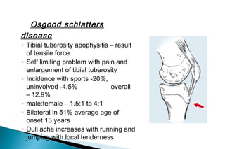Anterior knee pain | PPT