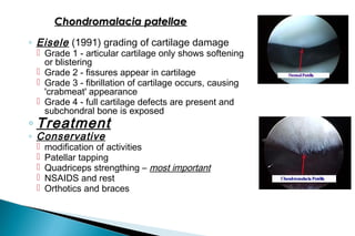 Anterior knee pain | PPT