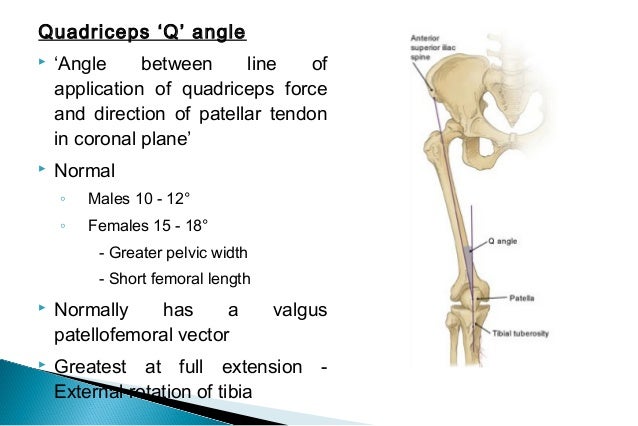 Q Angle Leg