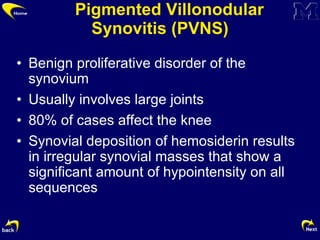 Anterior Knee Pain By Dr. Brian Sabb | PPT