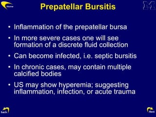 Anterior Knee Pain By Dr. Brian Sabb | PPT