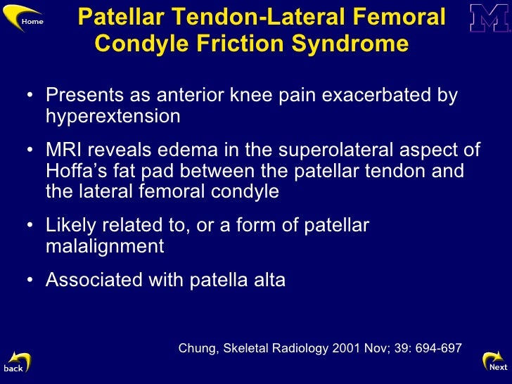Anterior Knee Pain By Dr. Brian Sabb