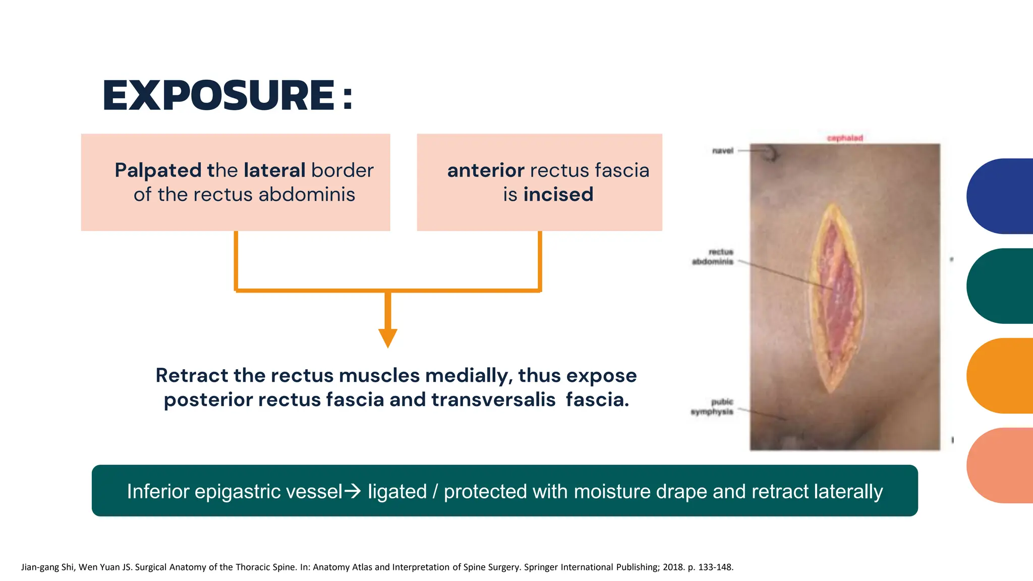Anterior Lumbal Surgery Approach- Arief.pptx