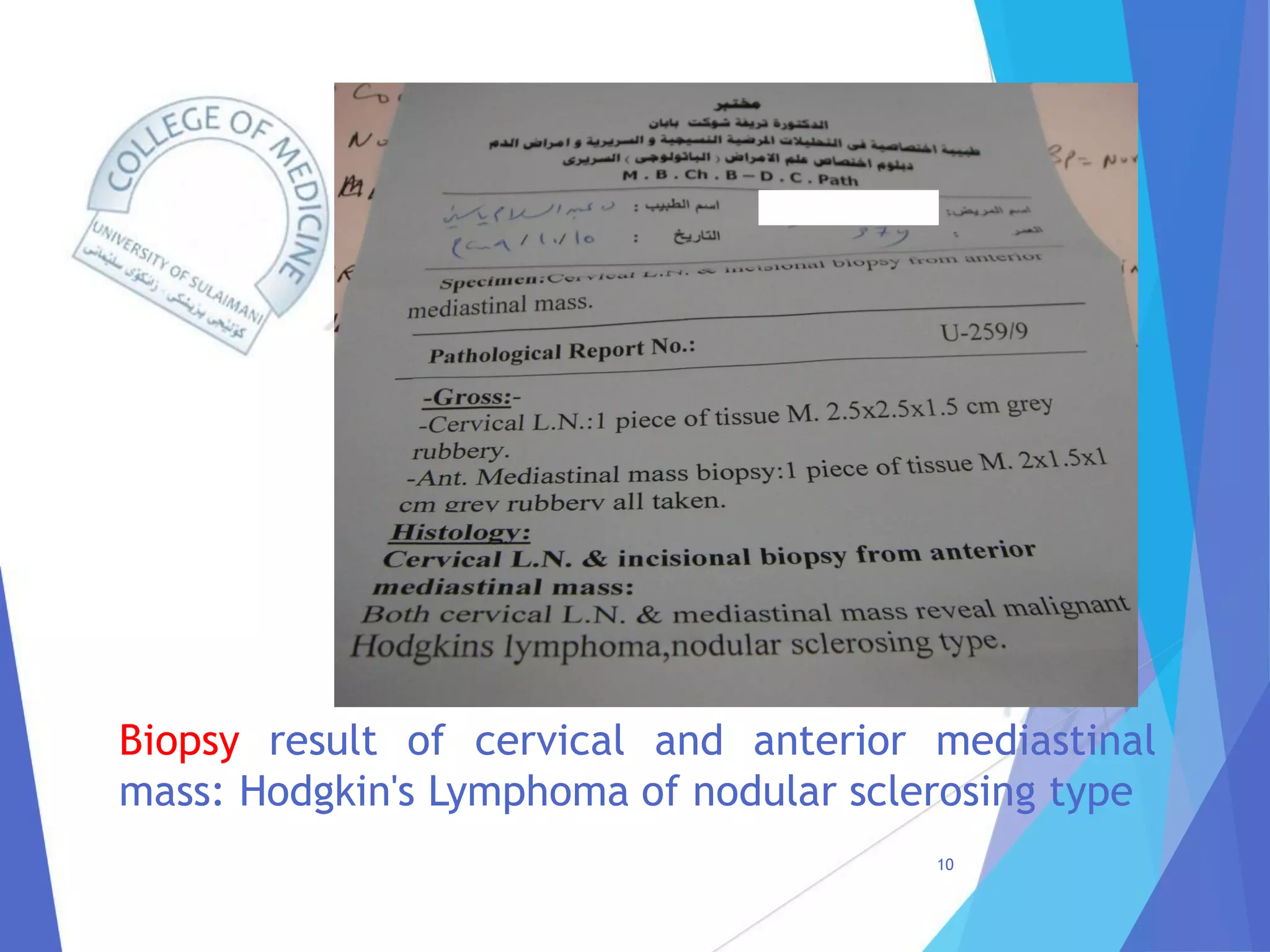 Anterior Mediastinotomy for Anterior Mediastinal Mass.pdf