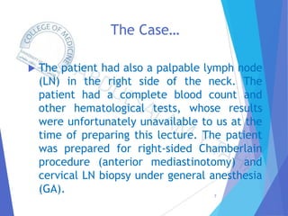 Anterior Mediastinotomy for Anterior Mediastinal Mass.pdf