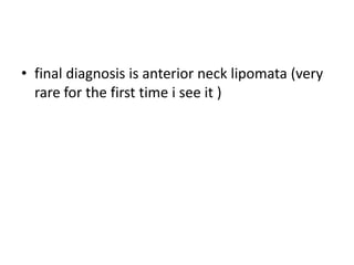 Anterior neck swelling | PPTX