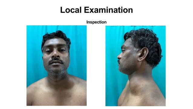 Anterior neck swelling with its differential diagnosis | PPTX