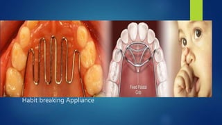 Anterior open bite aetiology and its management | PPTX