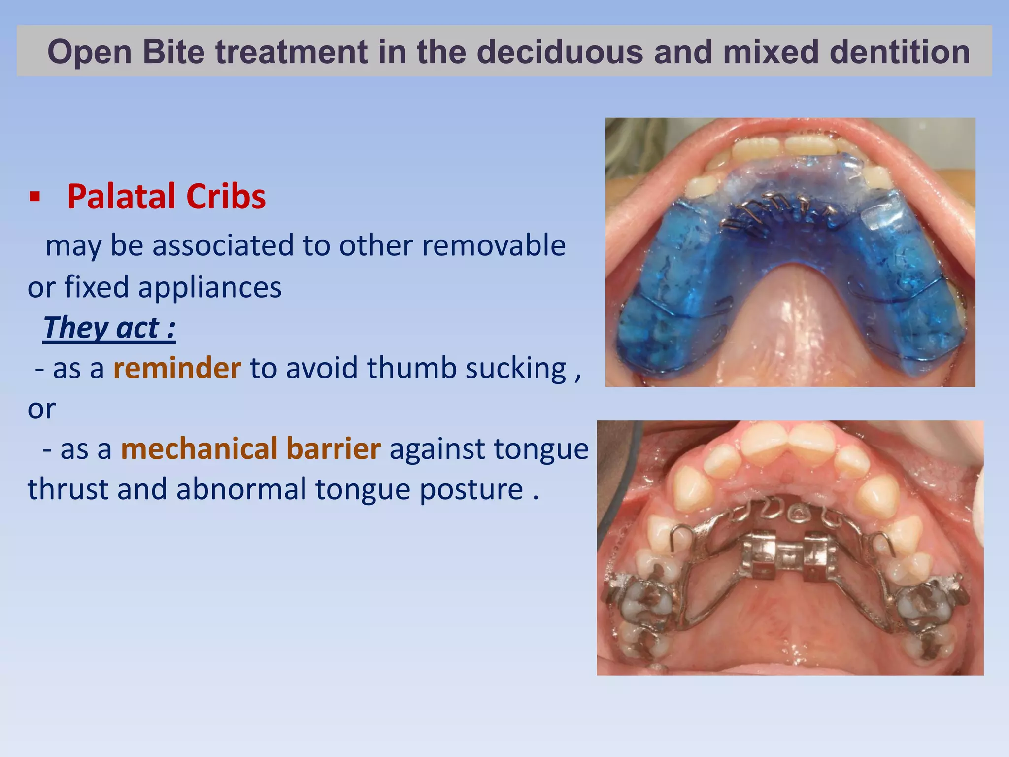 Anterior open bite treatment deciduous and mixed dentition .slide | PDF