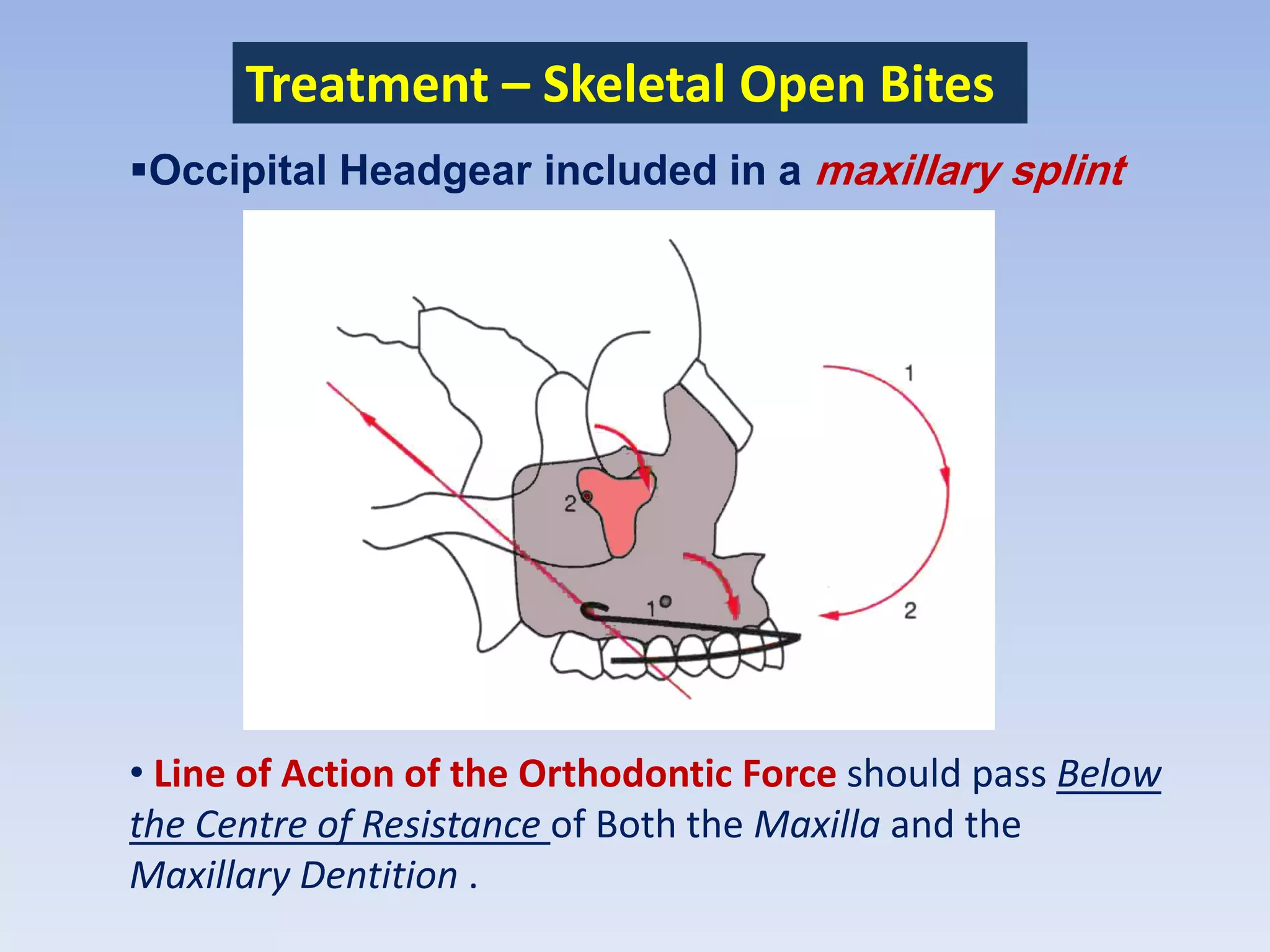 Anterior open bite treatment deciduous and mixed dentition .slide | PDF