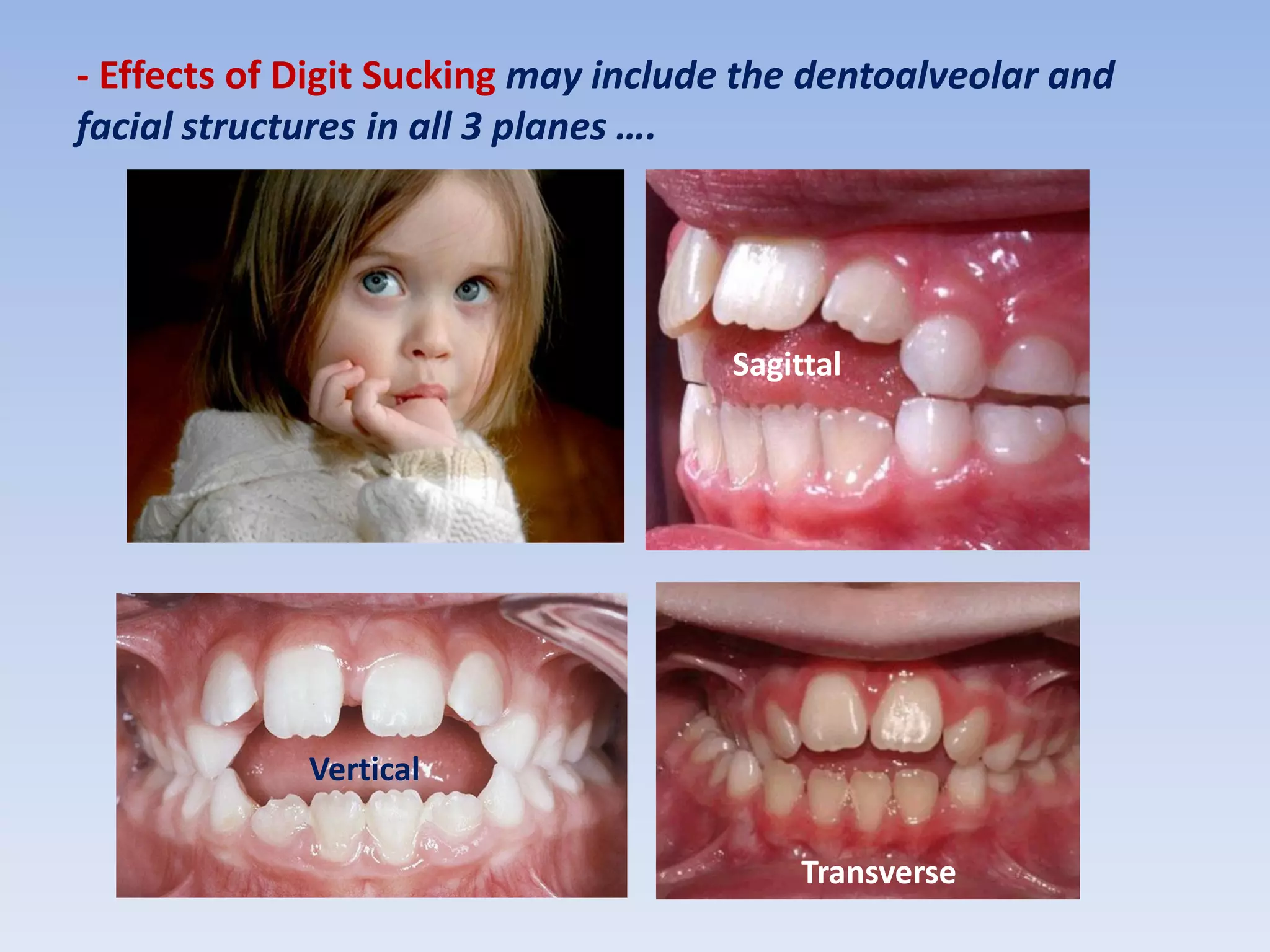Anterior open bite treatment deciduous and mixed dentition .slide | PDF