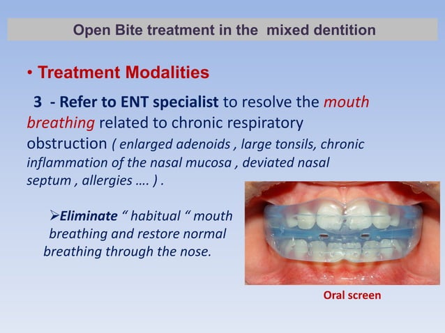 Anterior open bite treatment deciduous and mixed dentition .slide | PDF ...