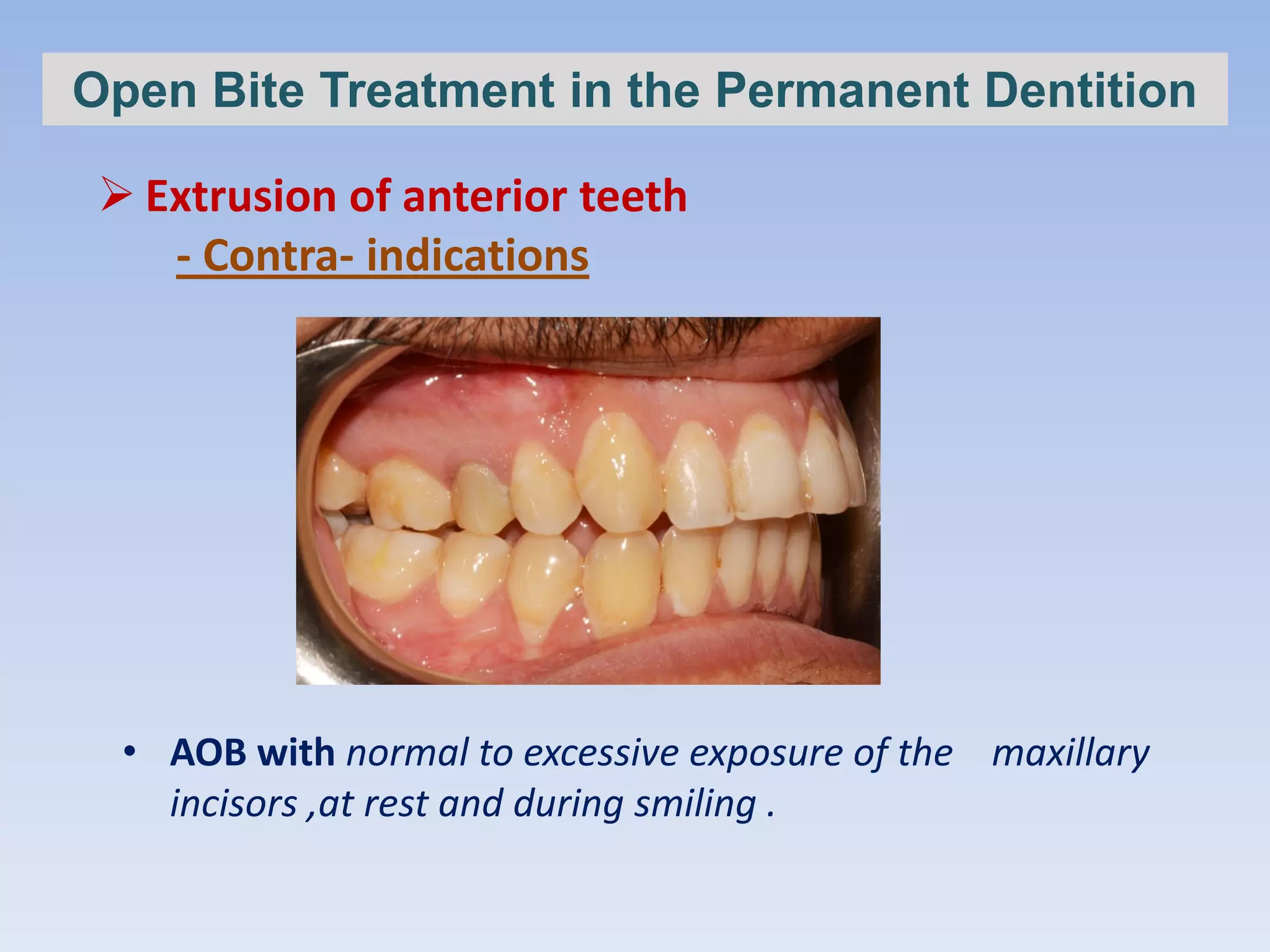 Anterior open bite treatment permanent dentition -1- .slide | PDF