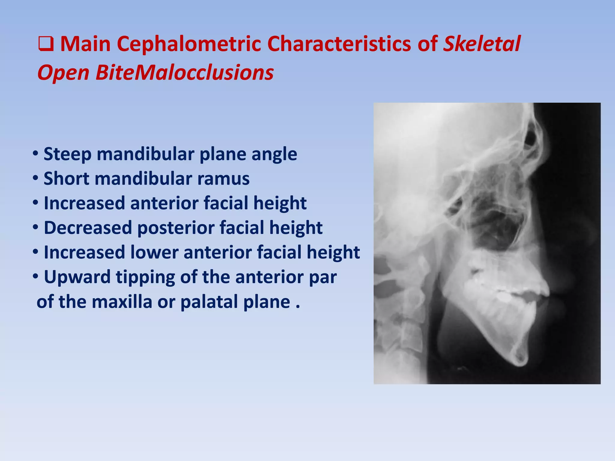 Anterior open bite treatment in the permanent dentition part 2- | PDF