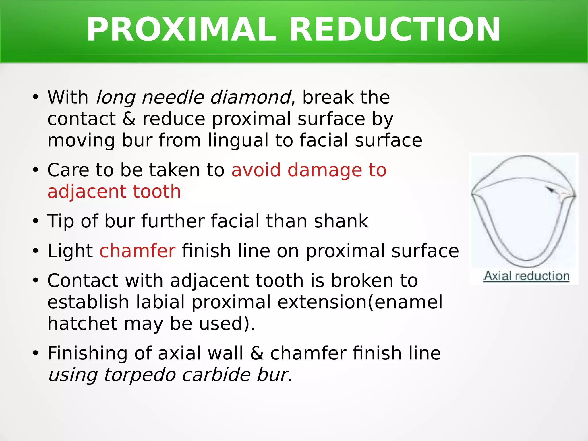 Anterior Partial Veneer crown preparation | PDF