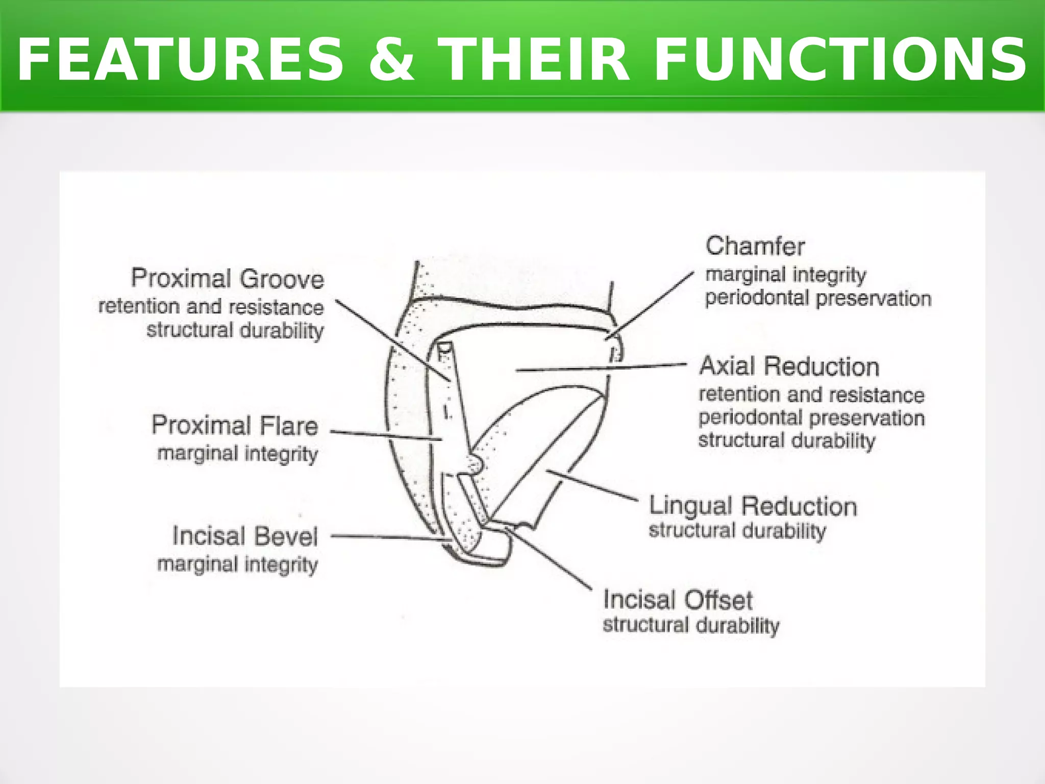 Anterior Partial Veneer crown preparation | PDF