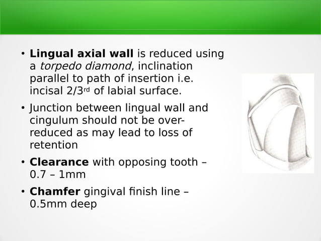 Anterior Partial Veneer crown preparation | PDF