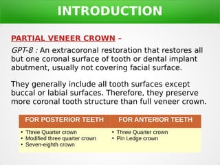 Anterior Partial Veneer crown preparation | PDF
