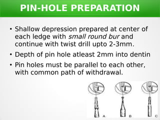Anterior Partial Veneer crown preparation | PDF