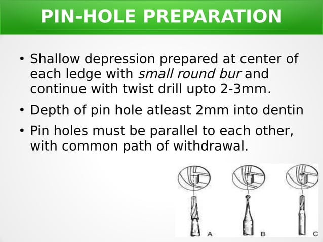 Anterior Partial Veneer crown preparation | PDF