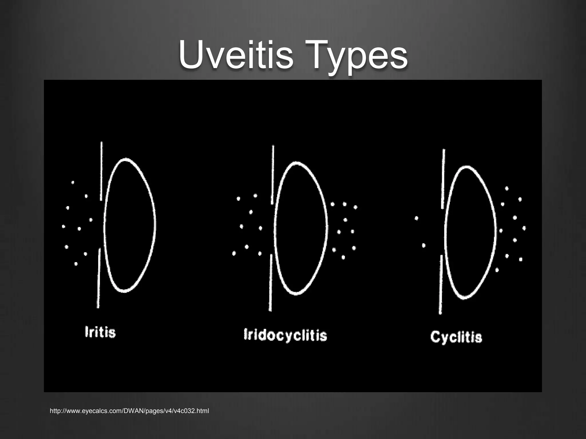 Anterior Pole - Dr. Scott Burdette | PPTX