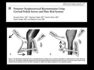 Anterior transoral atlantoaxial release and posterior instrumented ...