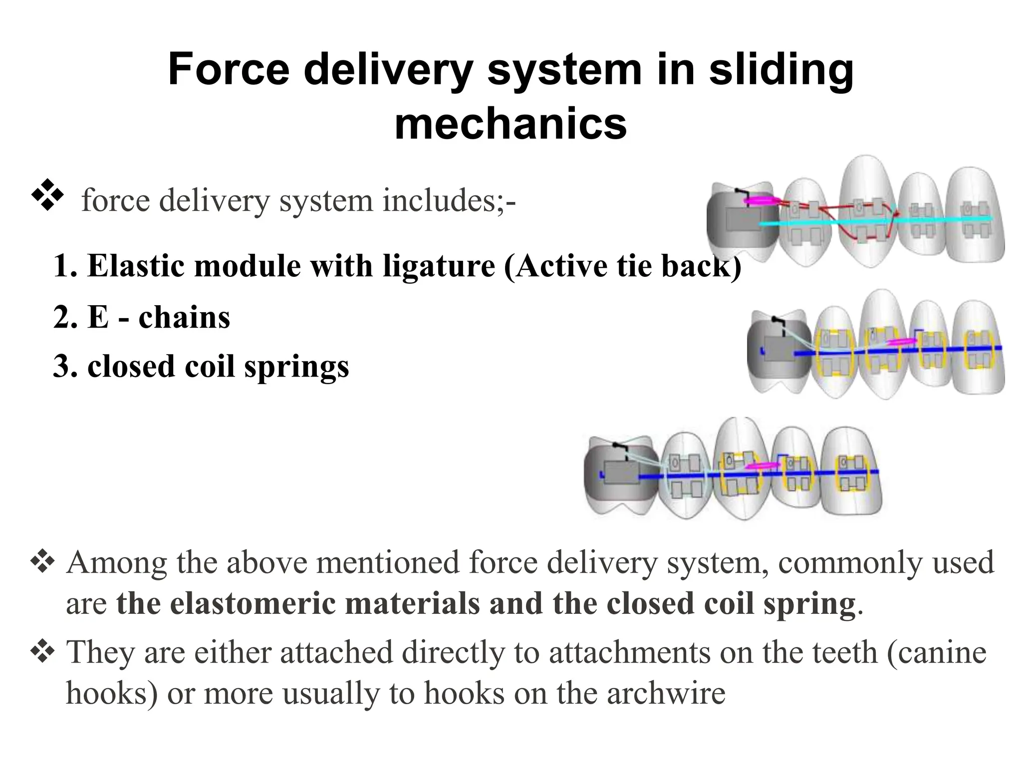 ANTERIOR RETRACTION MECHANICs in orthodonticsS 1.pptx