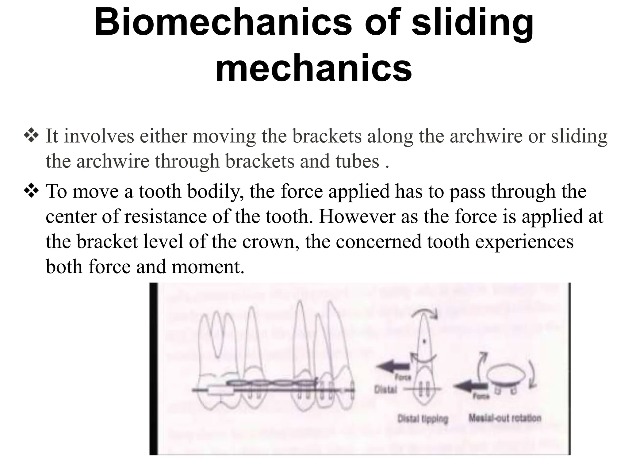 ANTERIOR RETRACTION MECHANICs in orthodonticsS 1.pptx