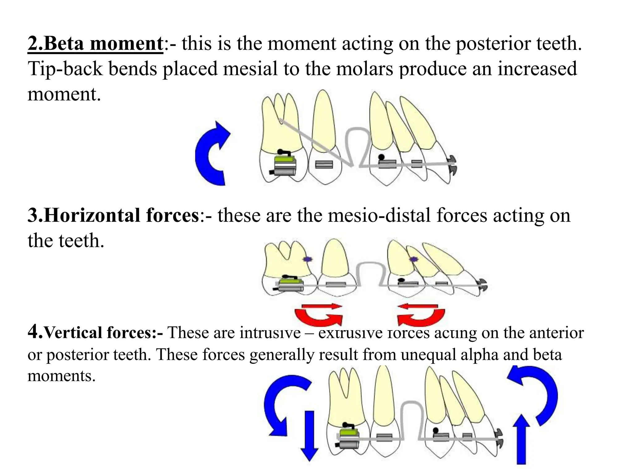 ANTERIOR RETRACTION MECHANICs in orthodonticsS 1.pptx