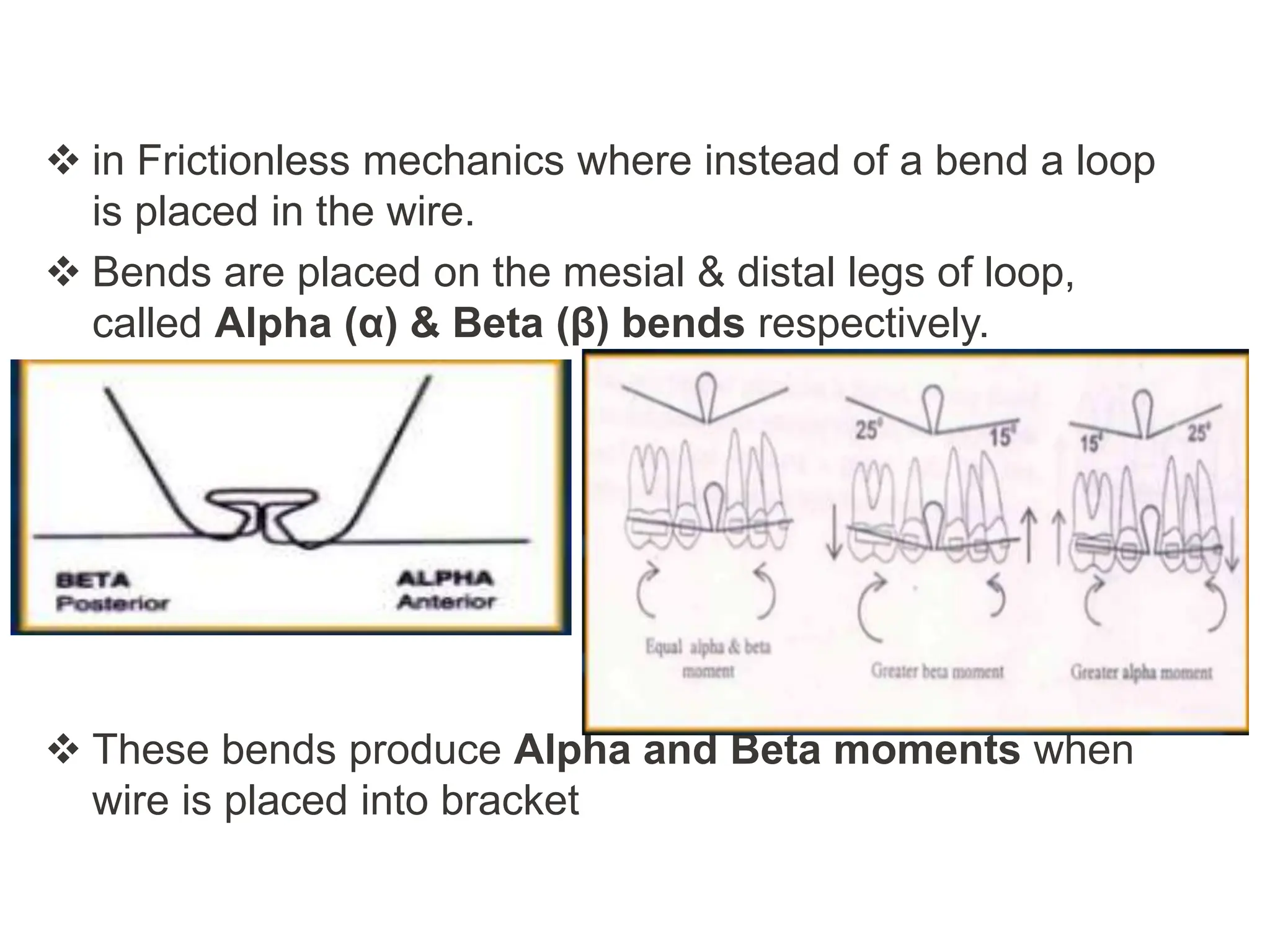 ANTERIOR RETRACTION MECHANICs in orthodonticsS 1.pptx