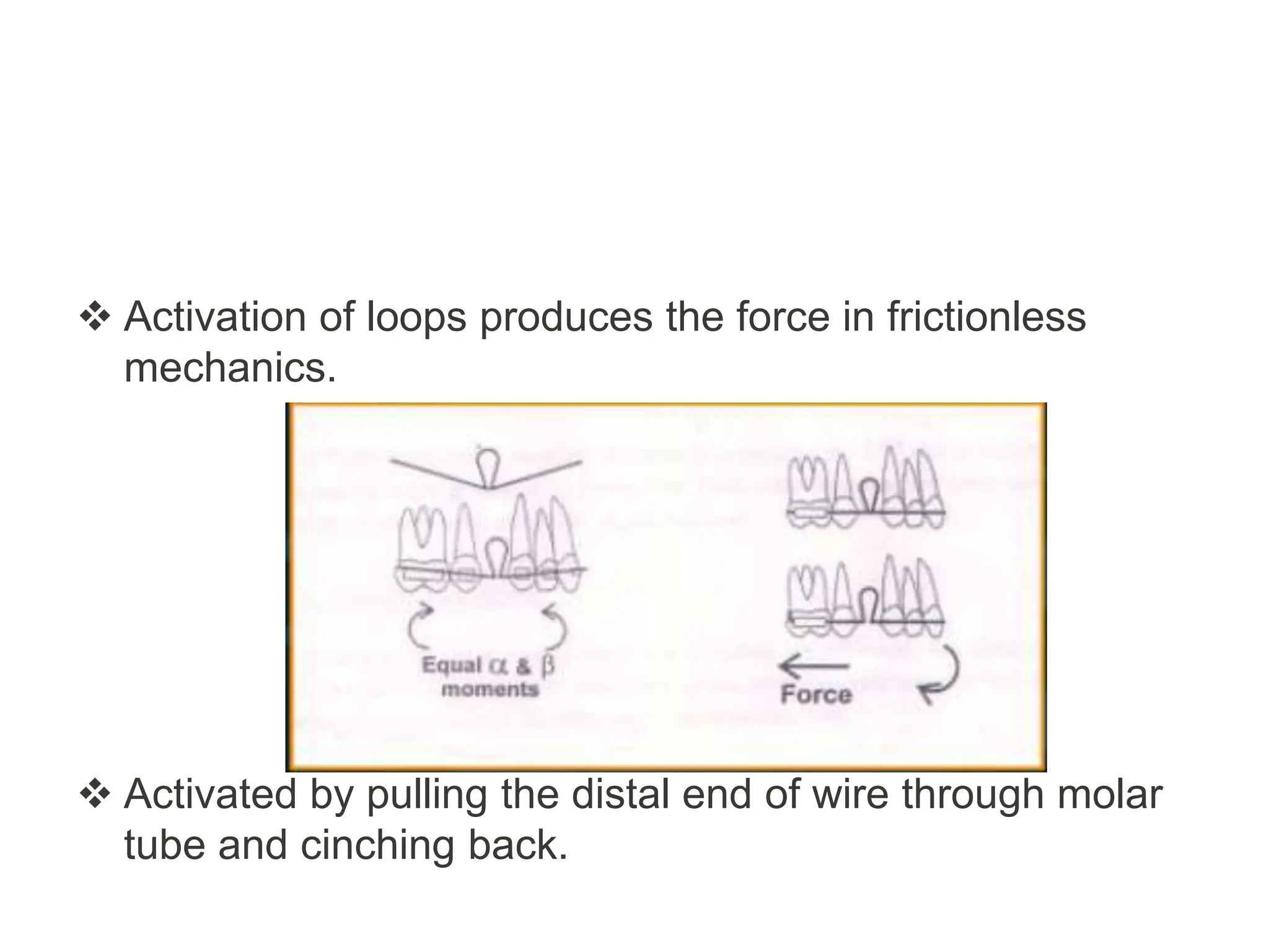 ANTERIOR RETRACTION MECHANICs in orthodonticsS 1.pptx