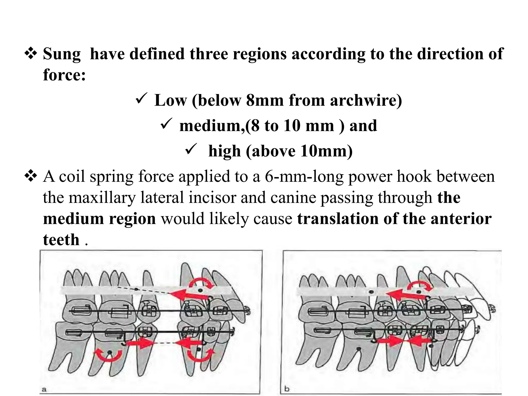 ANTERIOR RETRACTION MECHANICs in orthodonticsS 1.pptx