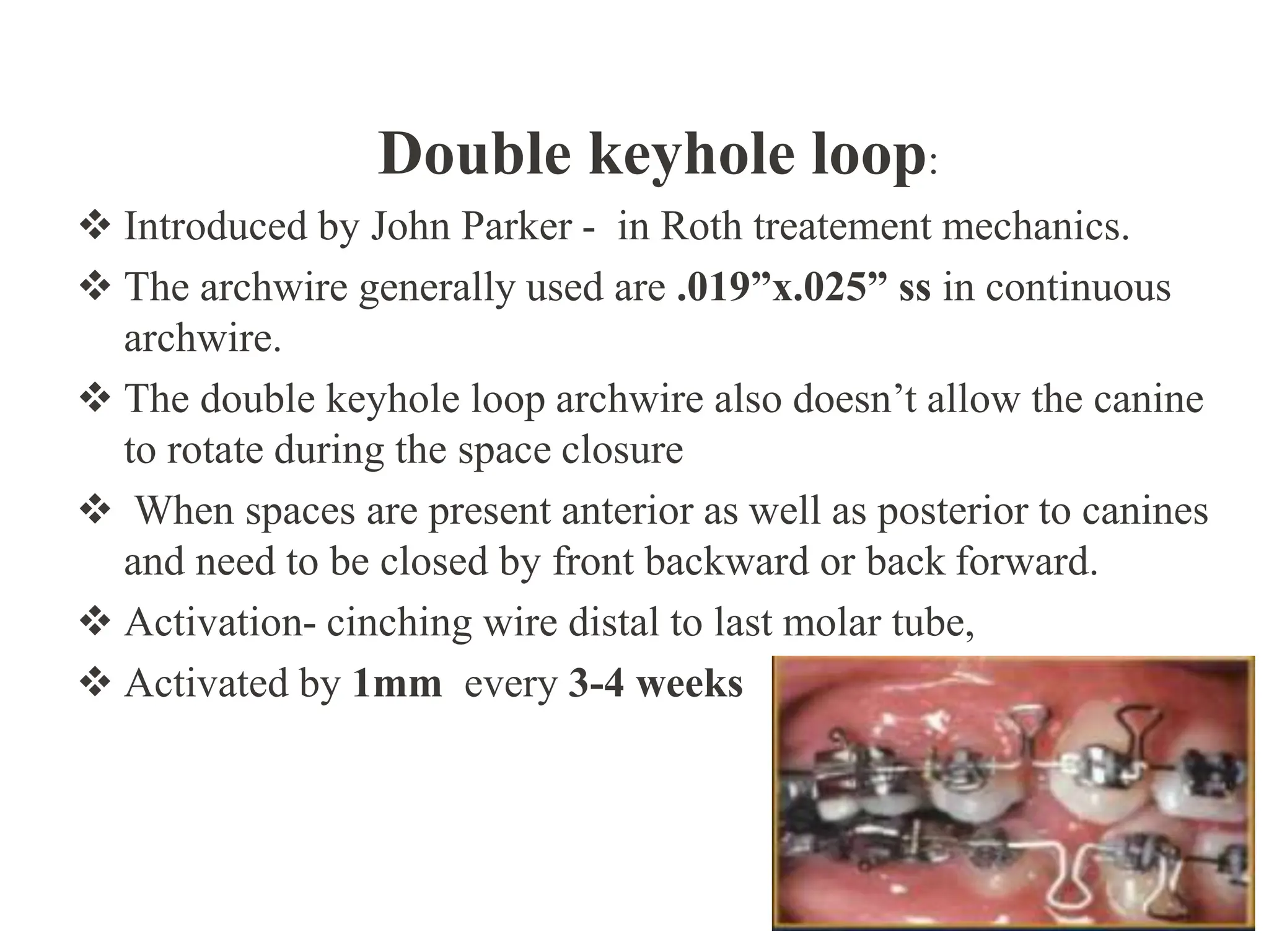 ANTERIOR RETRACTION MECHANICs in orthodonticsS 1.pptx