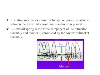 ANTERIOR RETRACTION MECHANICs in orthodonticsS 1.pptx