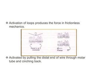 ANTERIOR RETRACTION MECHANICs in orthodonticsS 1.pptx