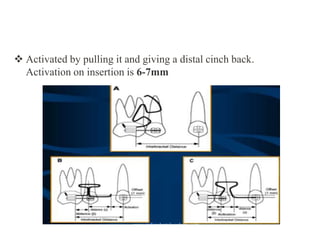 ANTERIOR RETRACTION MECHANICs in orthodonticsS 1.pptx