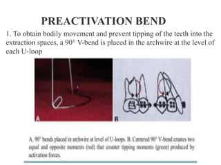 ANTERIOR RETRACTION MECHANICs in orthodonticsS 1.pptx