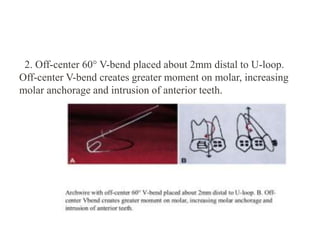 ANTERIOR RETRACTION MECHANICs in orthodonticsS 1.pptx