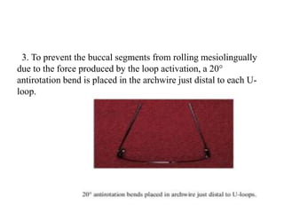 ANTERIOR RETRACTION MECHANICs in orthodonticsS 1.pptx