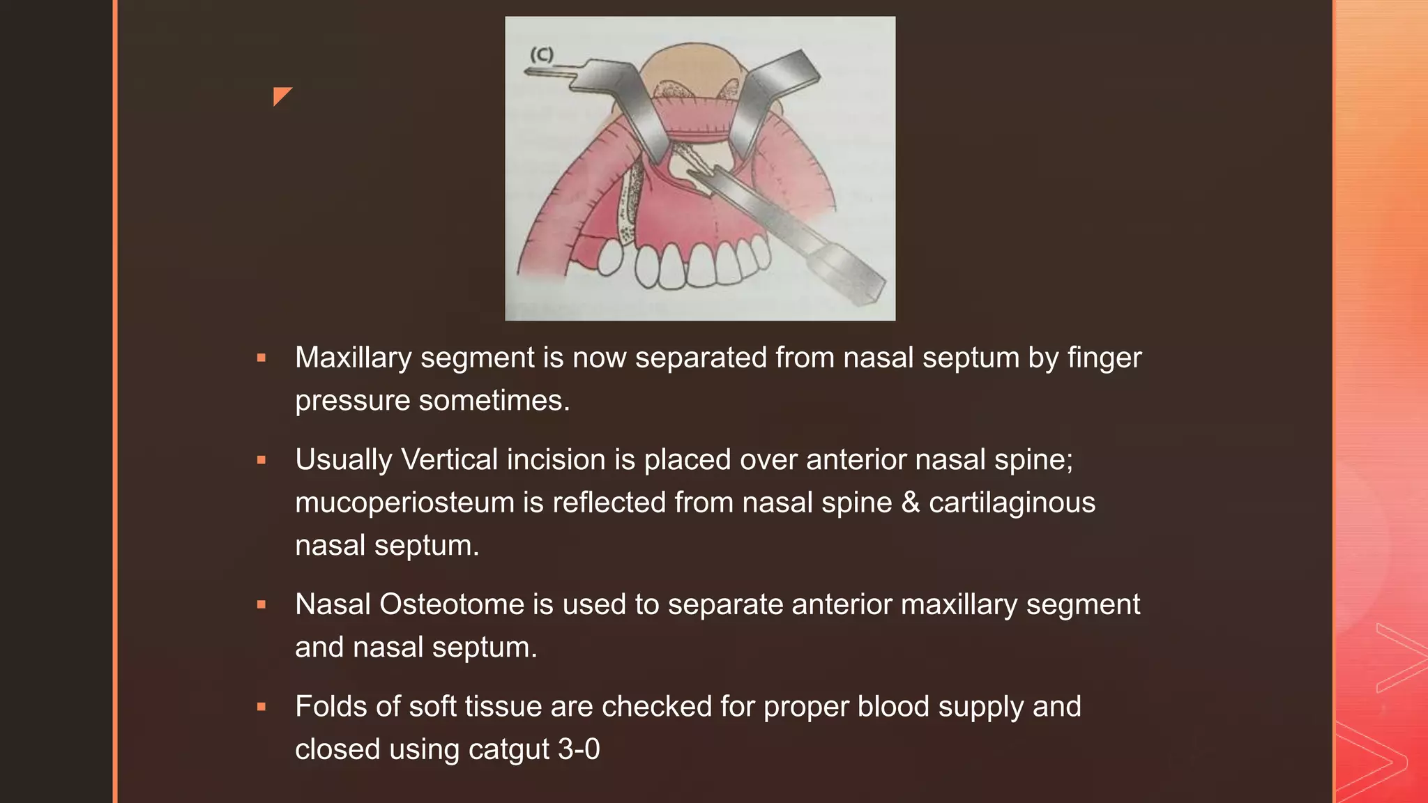 ANTERIOR SEGMENTAL MAXILLARY OSTEOTOMY.pptx