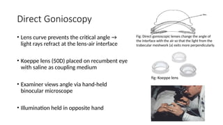 Anterior Segment Evaluation Techniques.pptx
